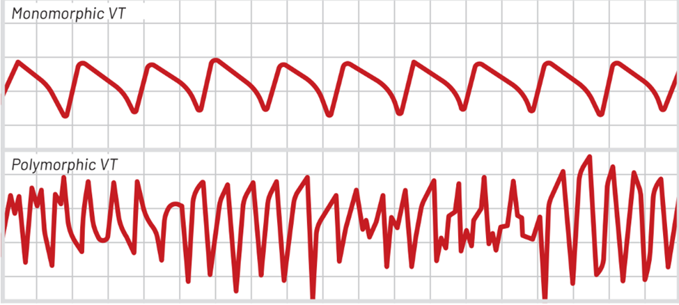 Rhythms to Defibrillate - Nicole Kupchik Blog